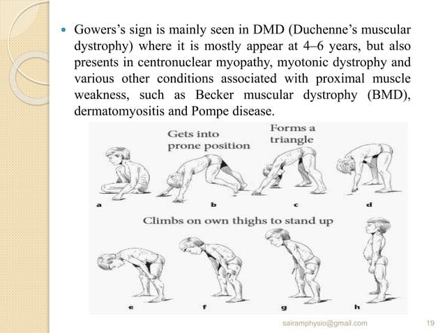 Neurological special tests.pptx | Death, Injury, or Military Conflict ...