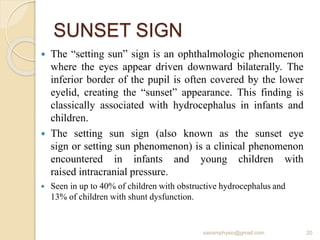 Neurological special tests.pptx | Death, Injury, or Military Conflict ...