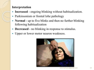 Neurological special tests.pptx