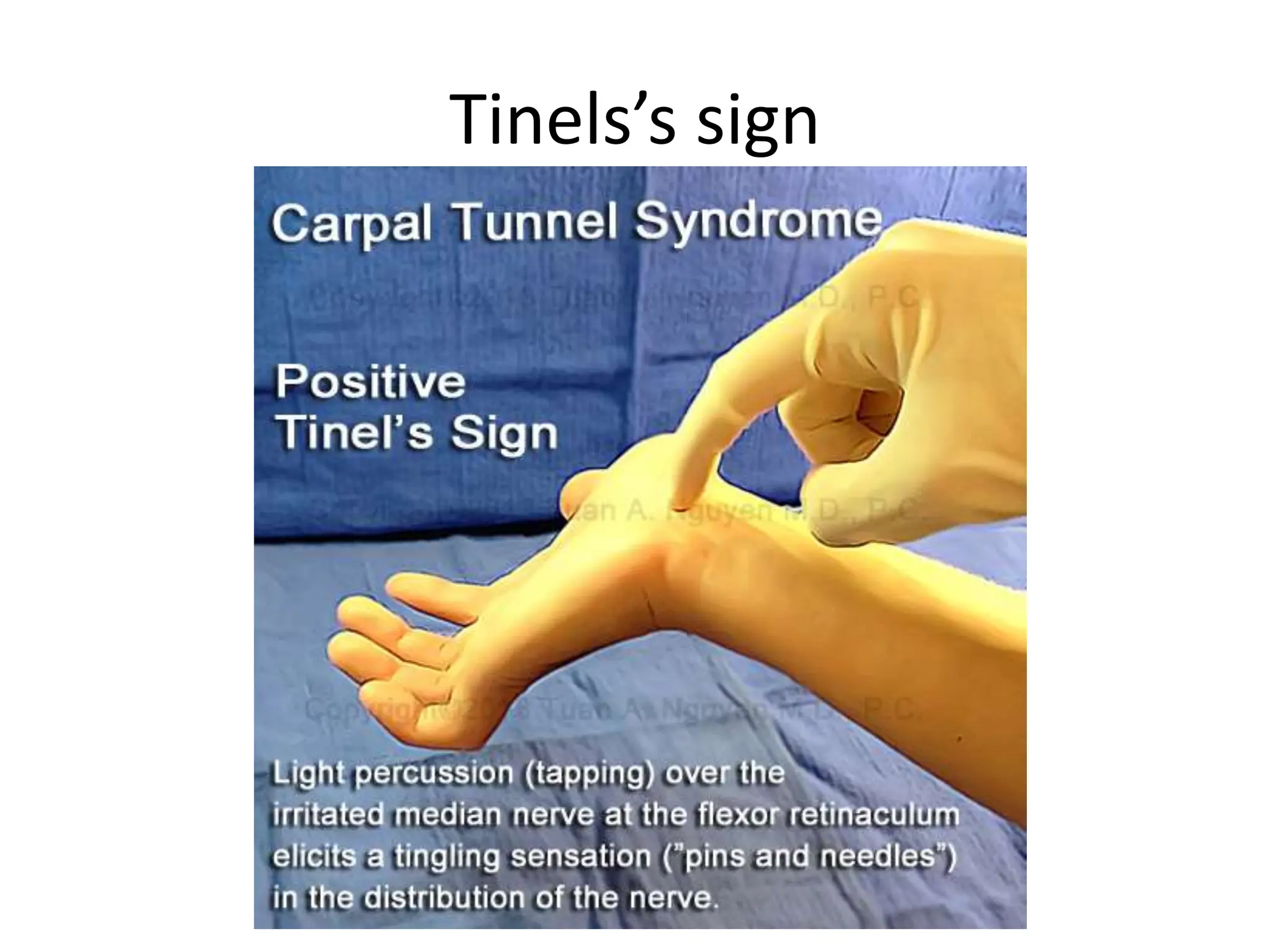 Special Tests in musculoskeletal physiotherapy.pptx