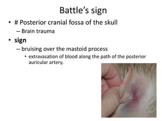 Special Tests in musculoskeletal physiotherapy.pptx