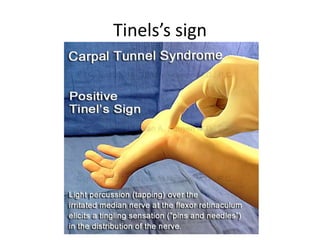 Special Tests in musculoskeletal physiotherapy.pptx