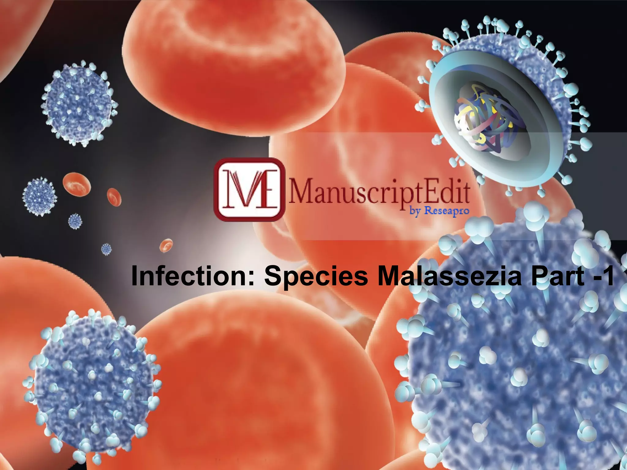 Infection: Species Malassezia Part -1 | PPT