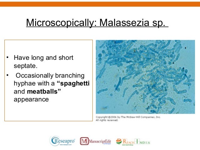 Infection Species Malassezia Part 1