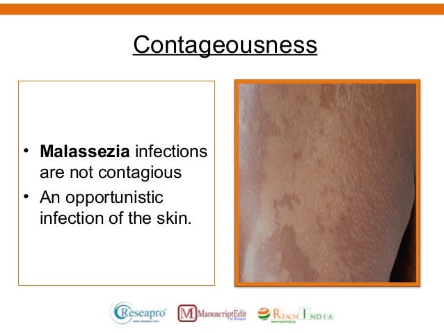 Infection Species Malassezia Part 1