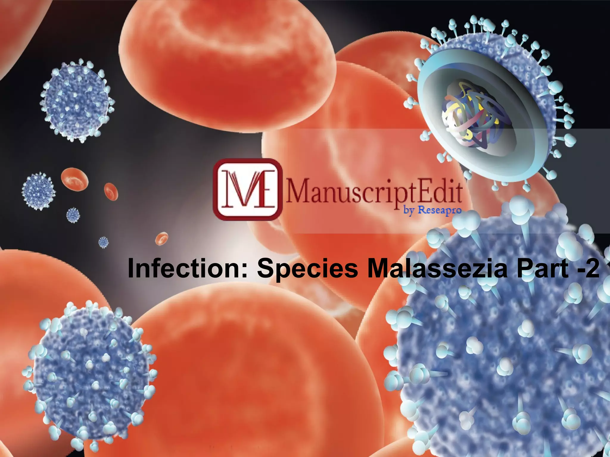 Infection: Species Malassezia Part -2 | PPT