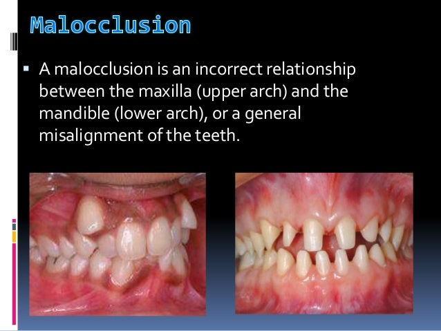 Specific causes of malocclusion