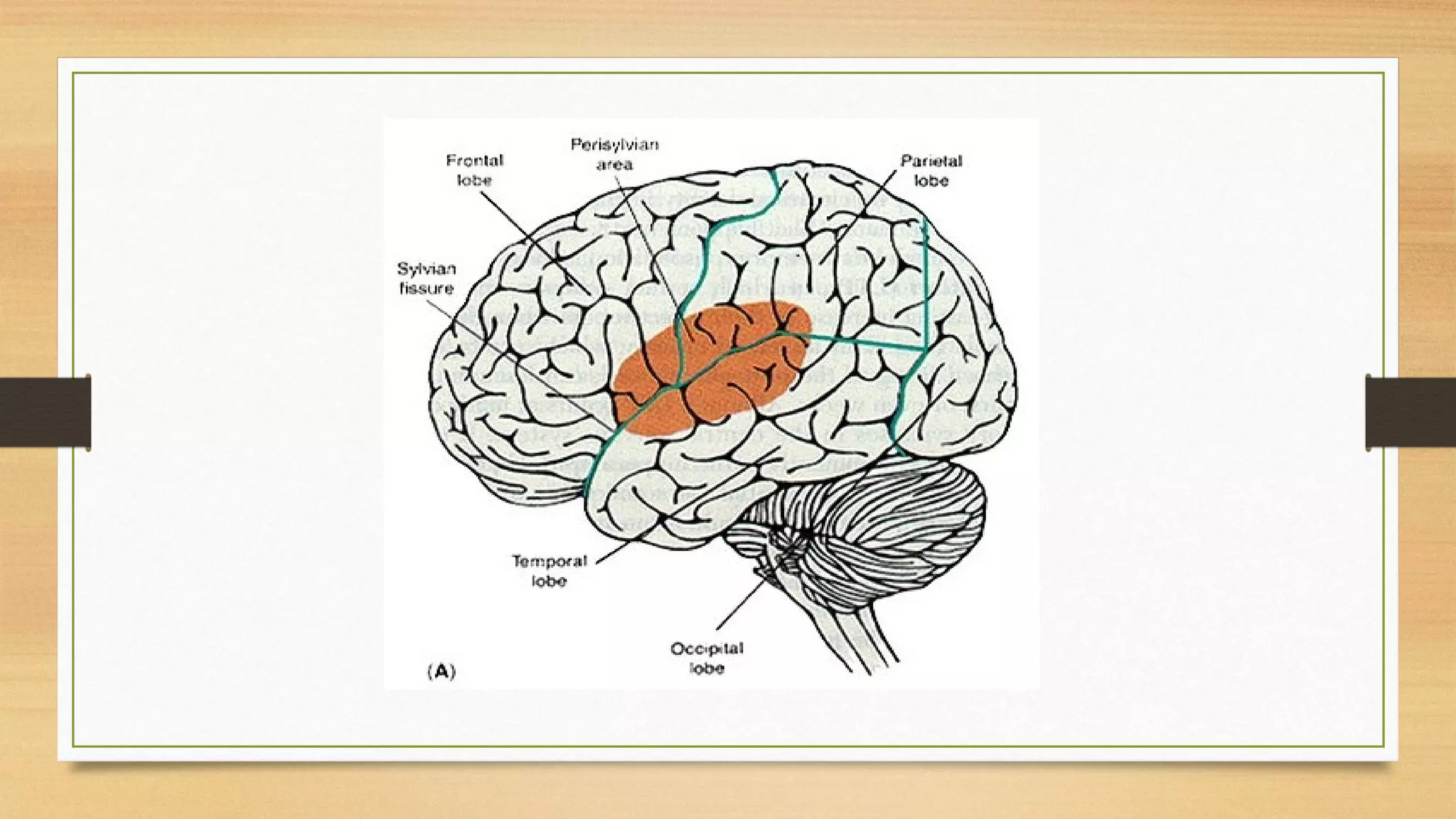 Specific learning disorder | PPT