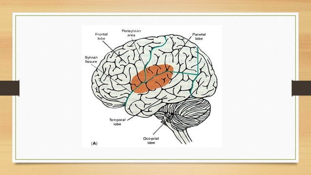 Specific learning disorder | PPT | Brain and Nervous System Disorders ...