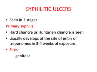 Specific ulcers | PPTX
