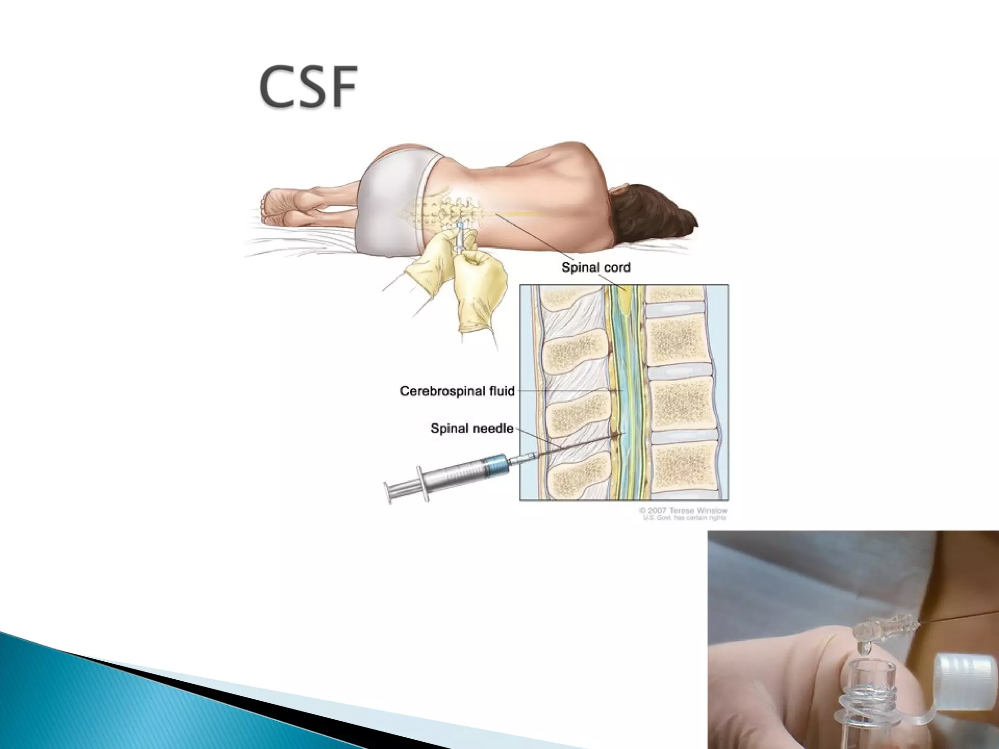 Specimen collection | PPT