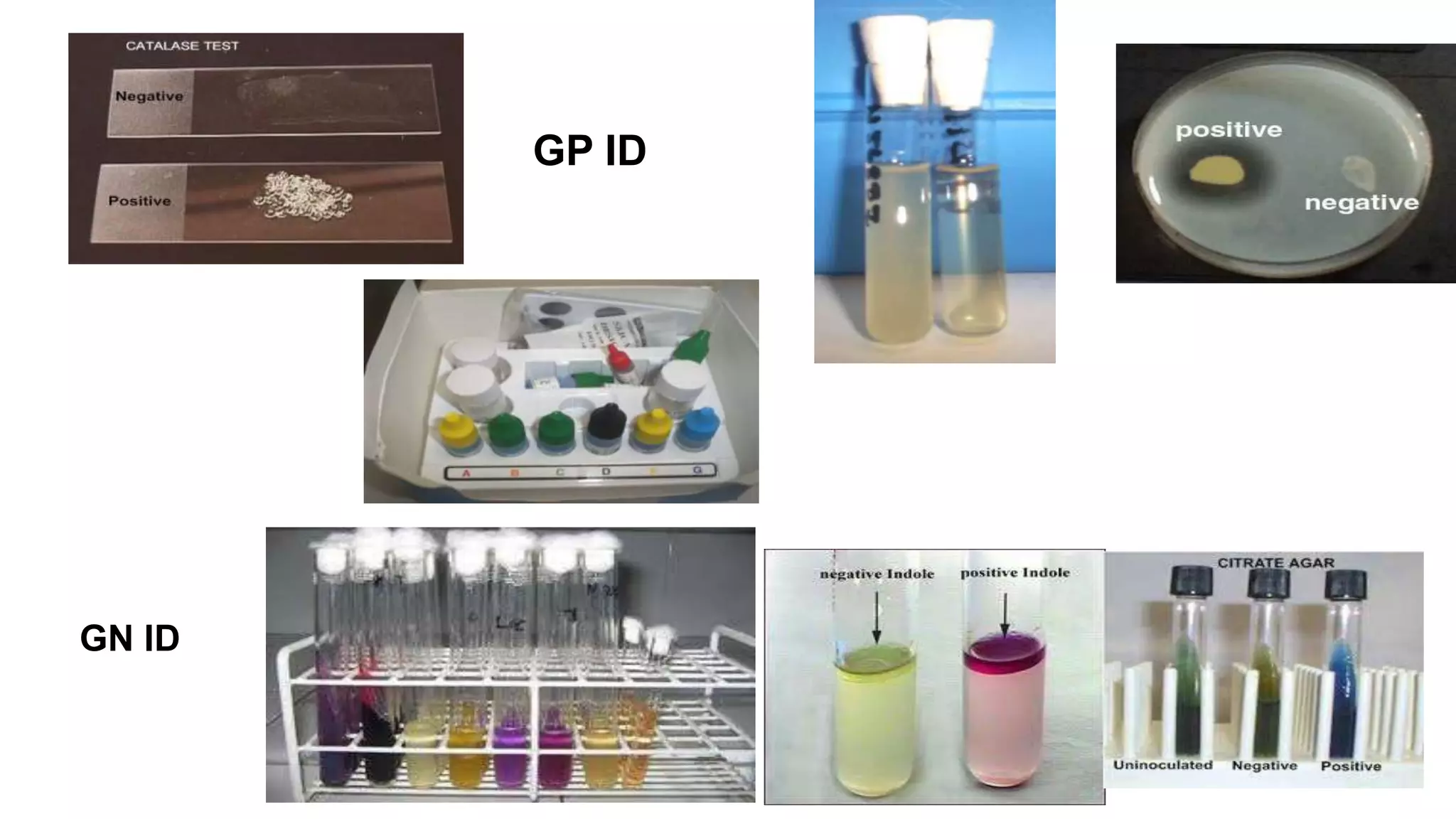 Specimen collection for clinical microbiology laboratory | PPTX