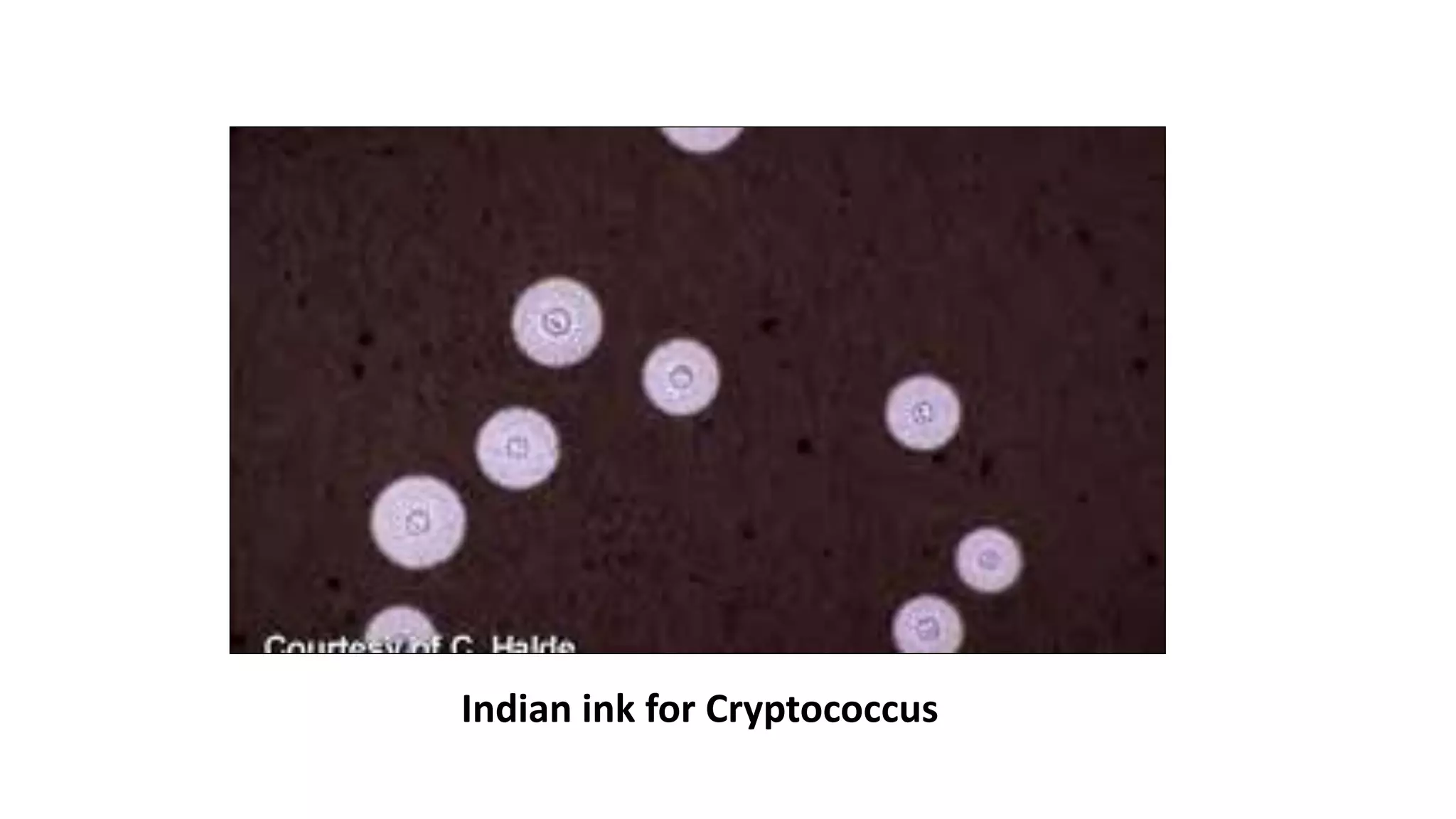 Specimen collection for clinical microbiology laboratory | PPTX