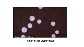 Specimen collection for clinical microbiology laboratory | PPTX