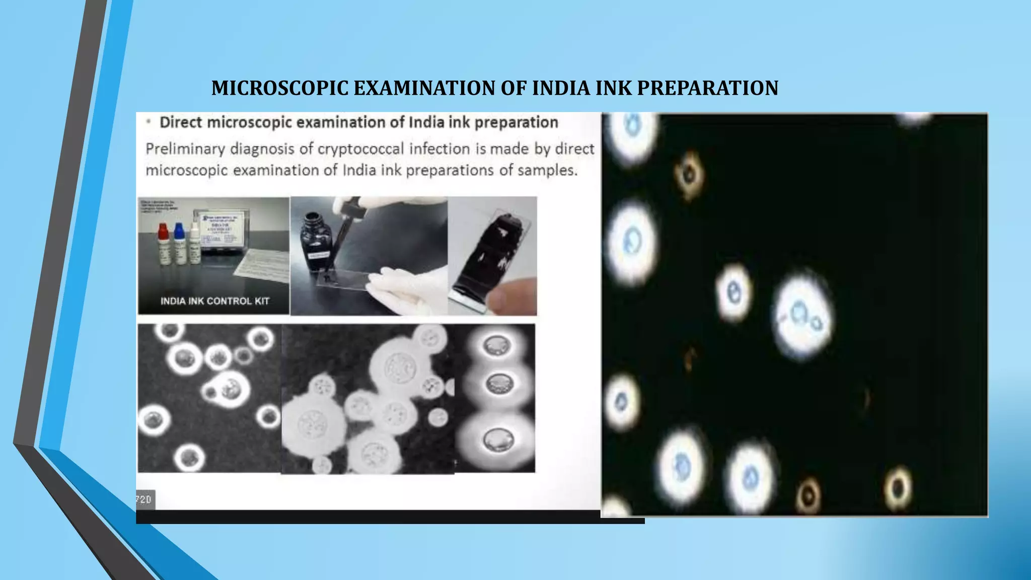 Specimen collection in mycology | PPTX