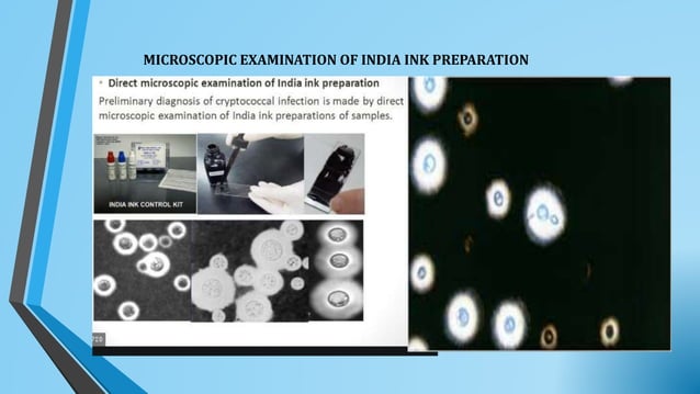 Specimen collection in mycology | PPTX | Skin and Dermatology | Diseases and Conditions