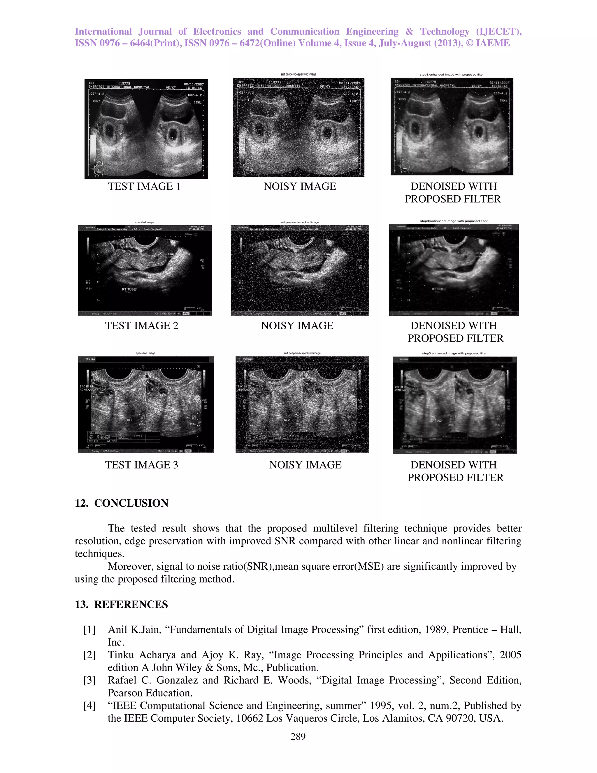 Speckle noise reduction from medical ultrasound images using wavelet thresh | PDF