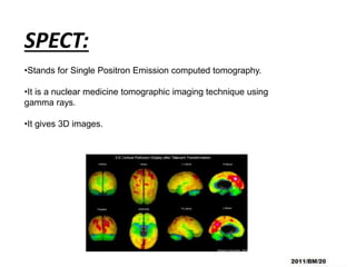 SPECT | PPTX