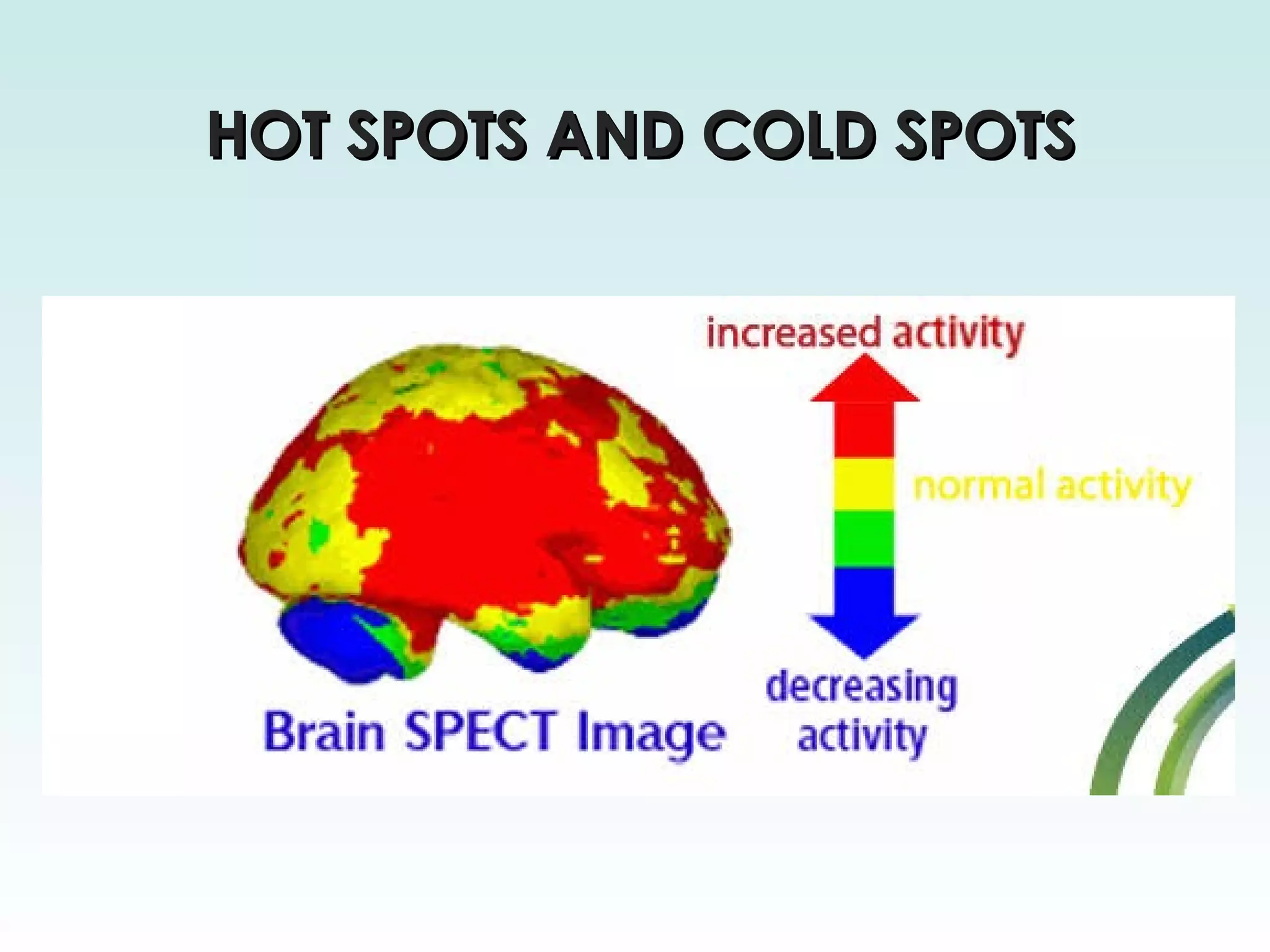 SPECT: Single Photon Emission Computed Tomography | PPT