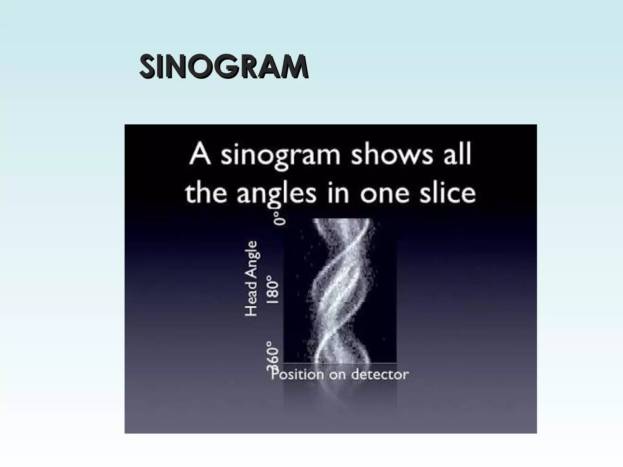 SPECT: Single Photon Emission Computed Tomography | PPT