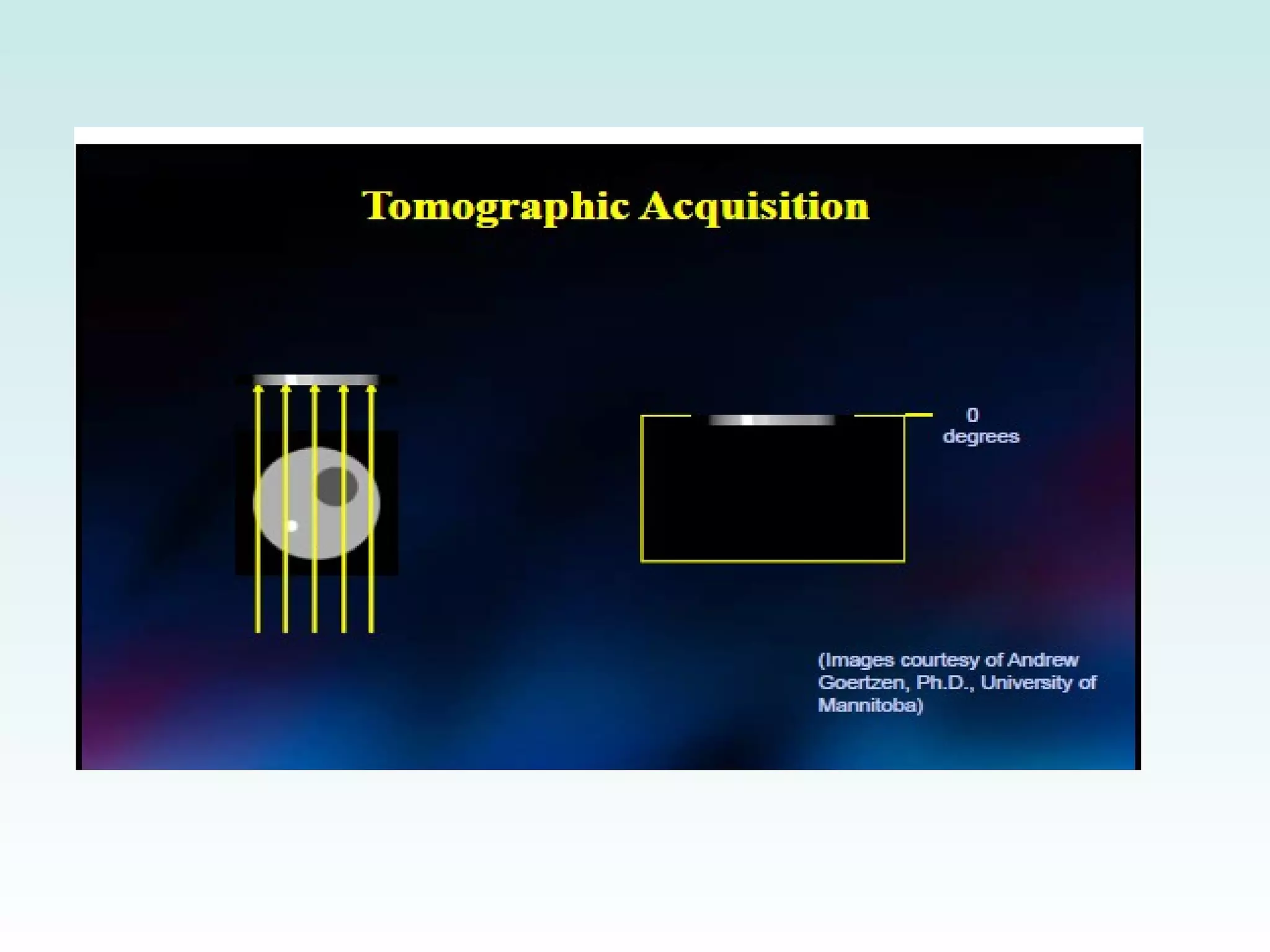 SPECT: Single Photon Emission Computed Tomography | PPT