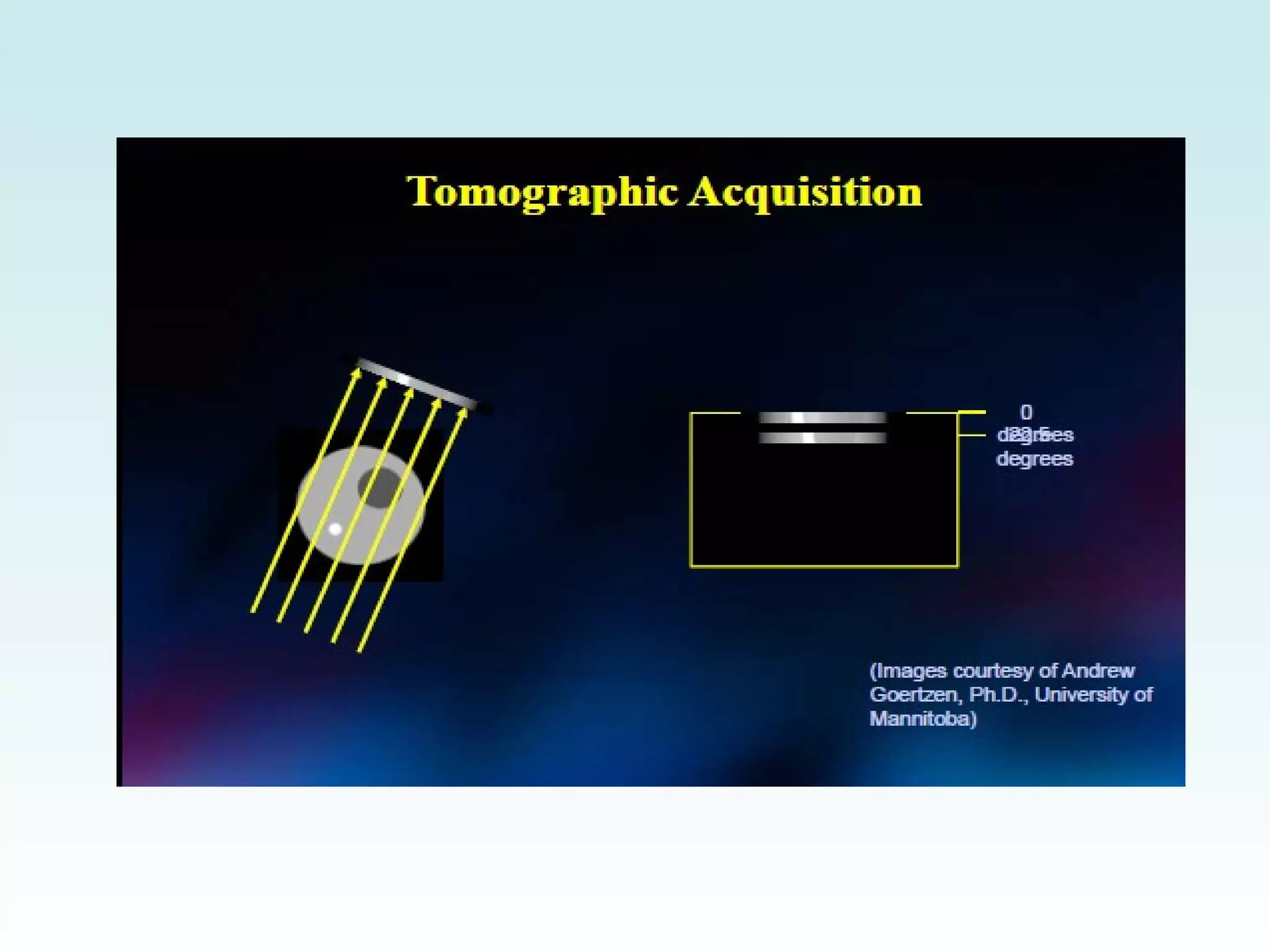 SPECT: Single Photon Emission Computed Tomography | PPT