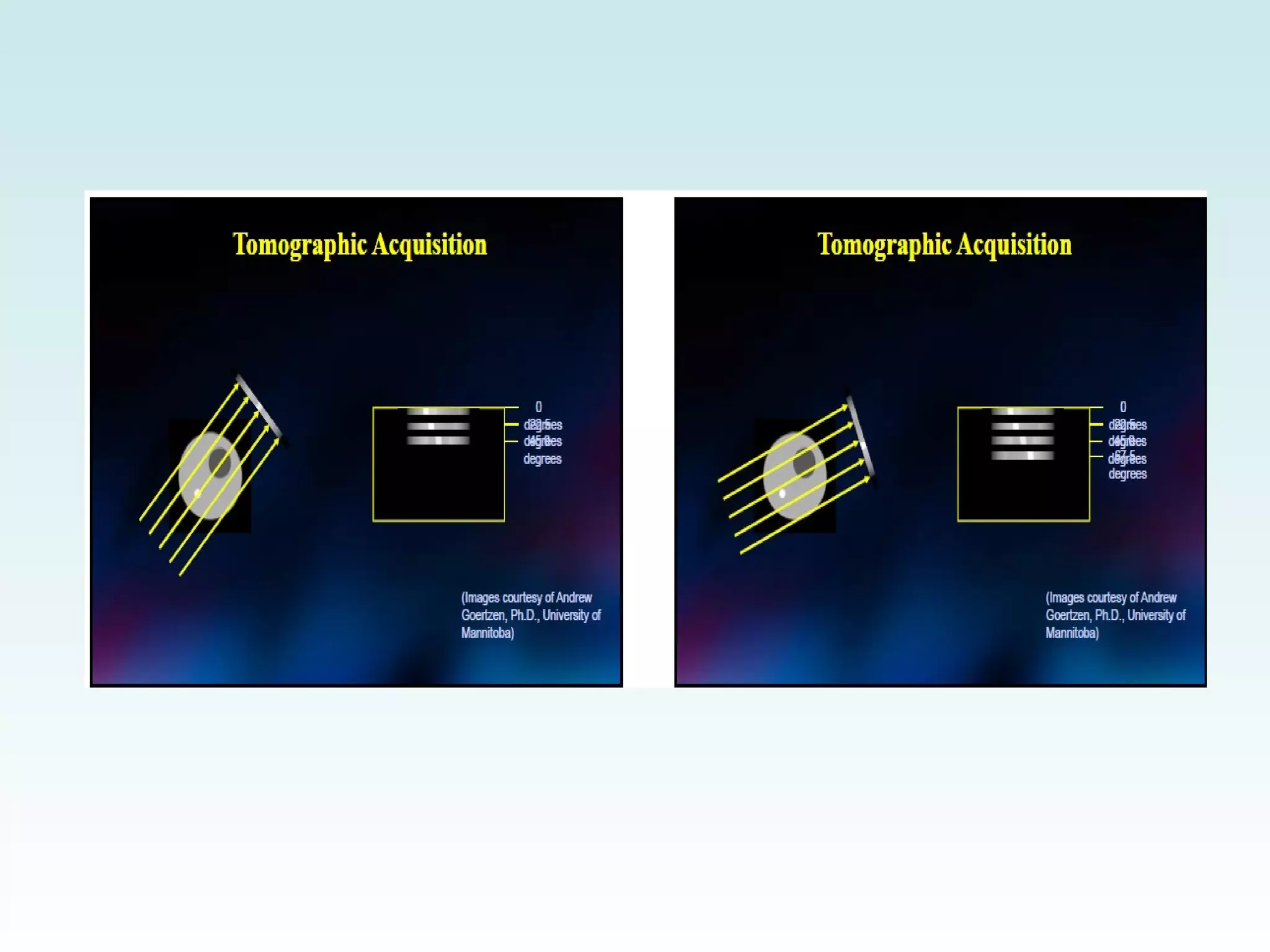 SPECT: Single Photon Emission Computed Tomography | PPT