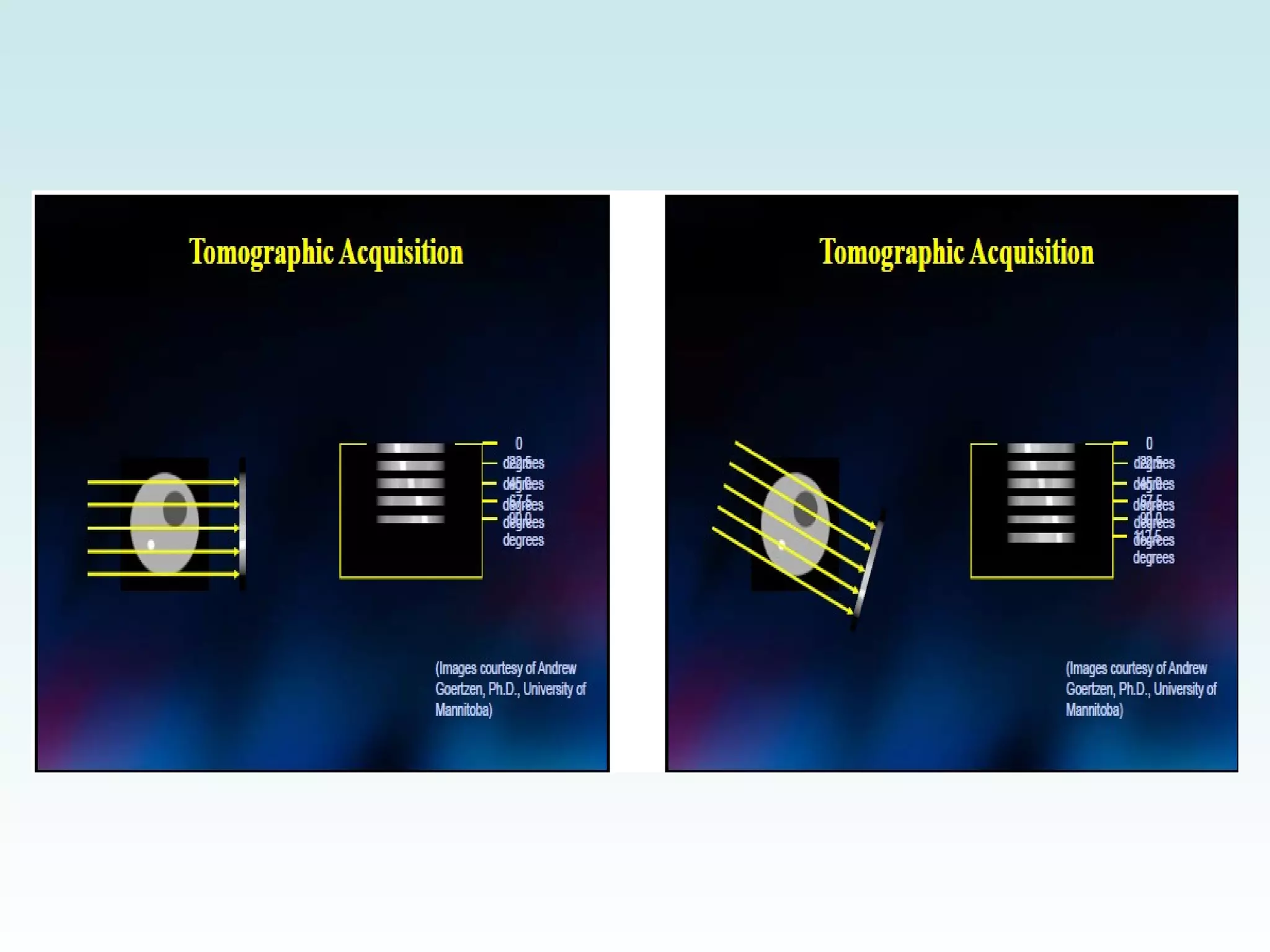 SPECT: Single Photon Emission Computed Tomography | PPT