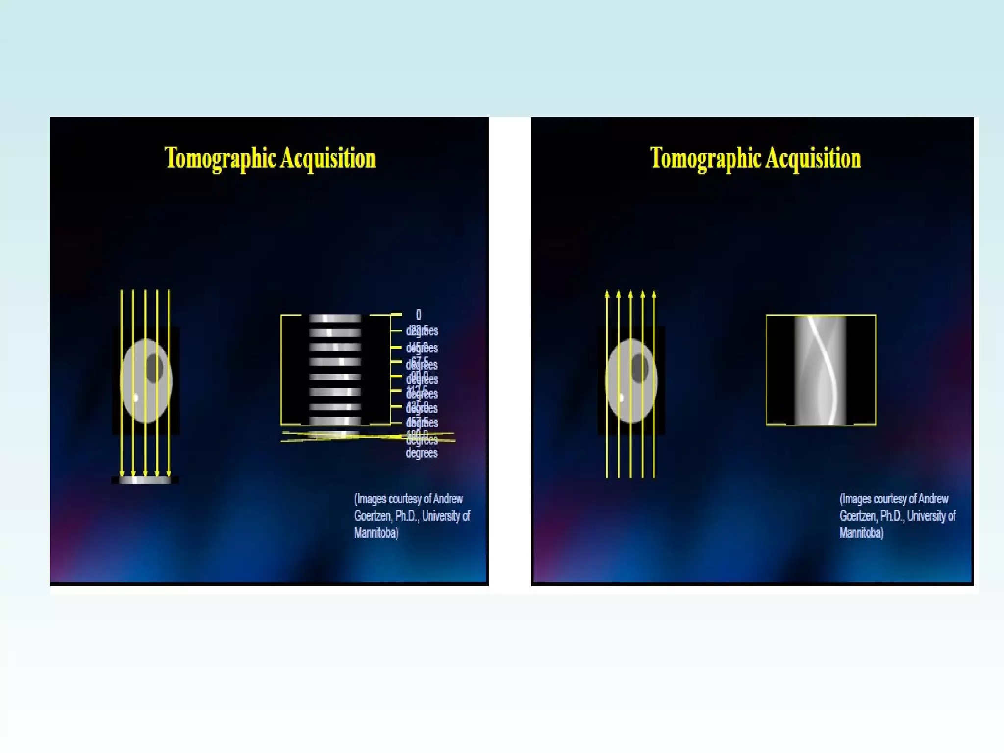 SPECT: Single Photon Emission Computed Tomography | PPT