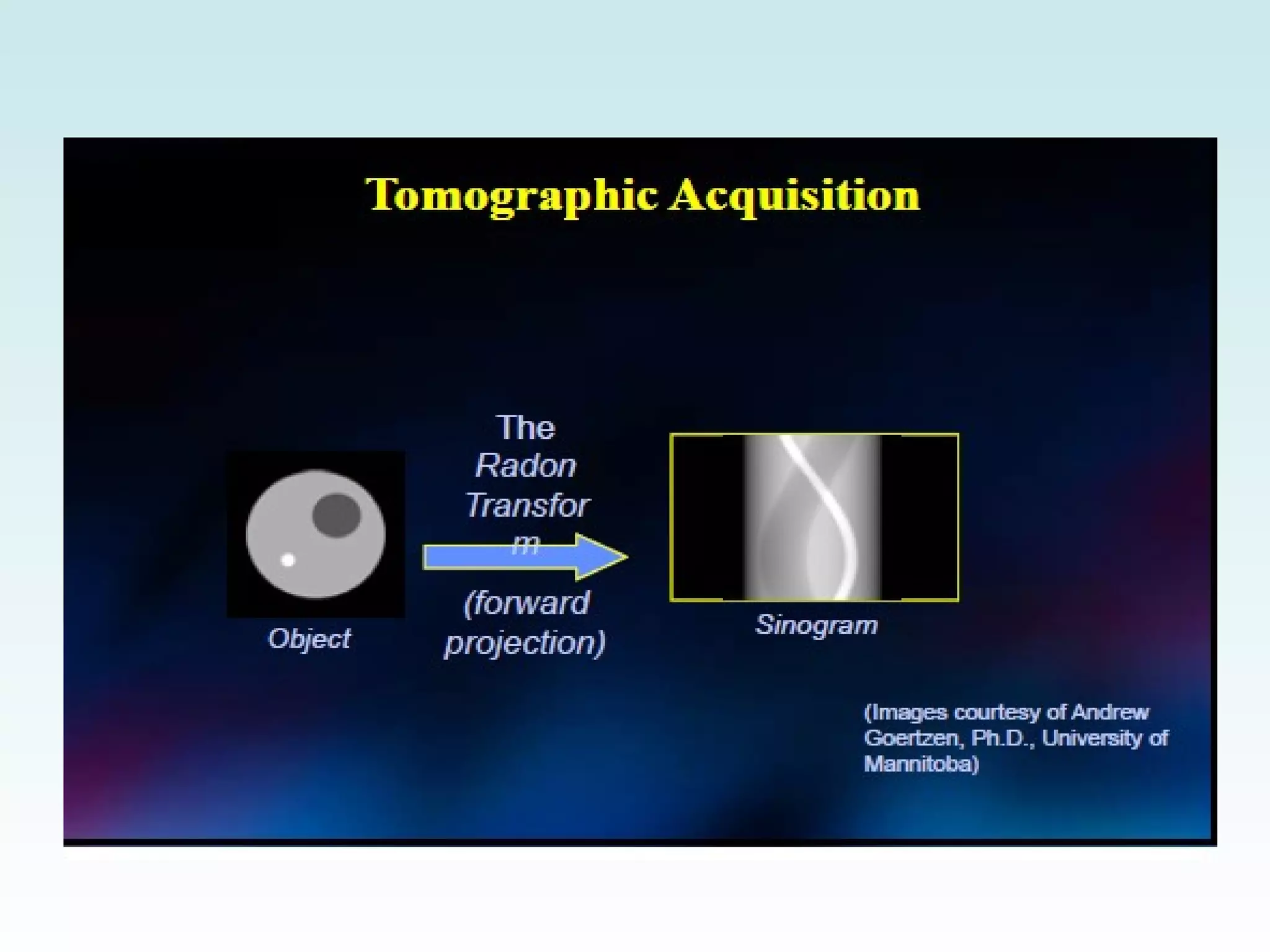 SPECT: Single Photon Emission Computed Tomography | PPT