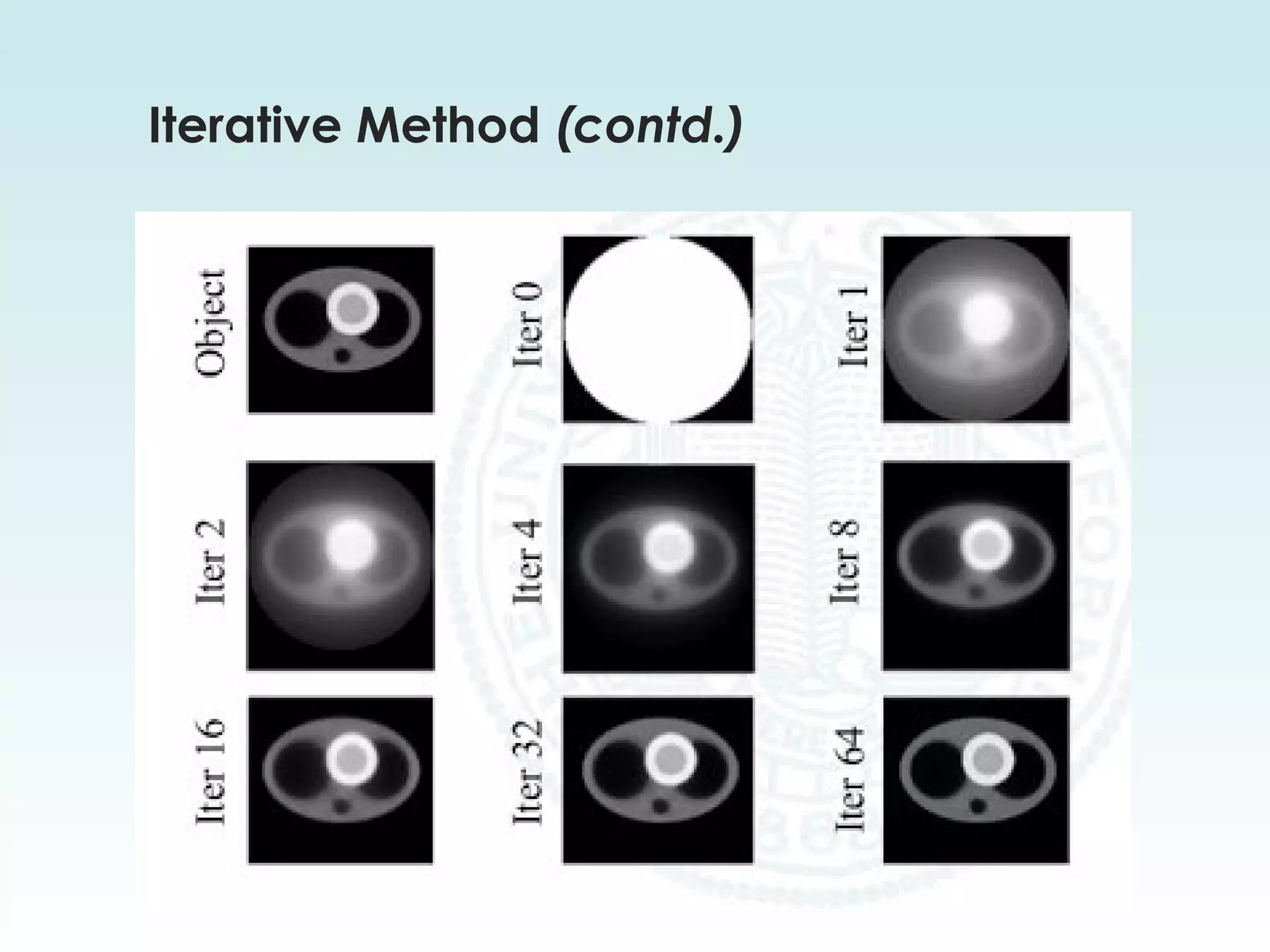 SPECT: Single Photon Emission Computed Tomography | PPT