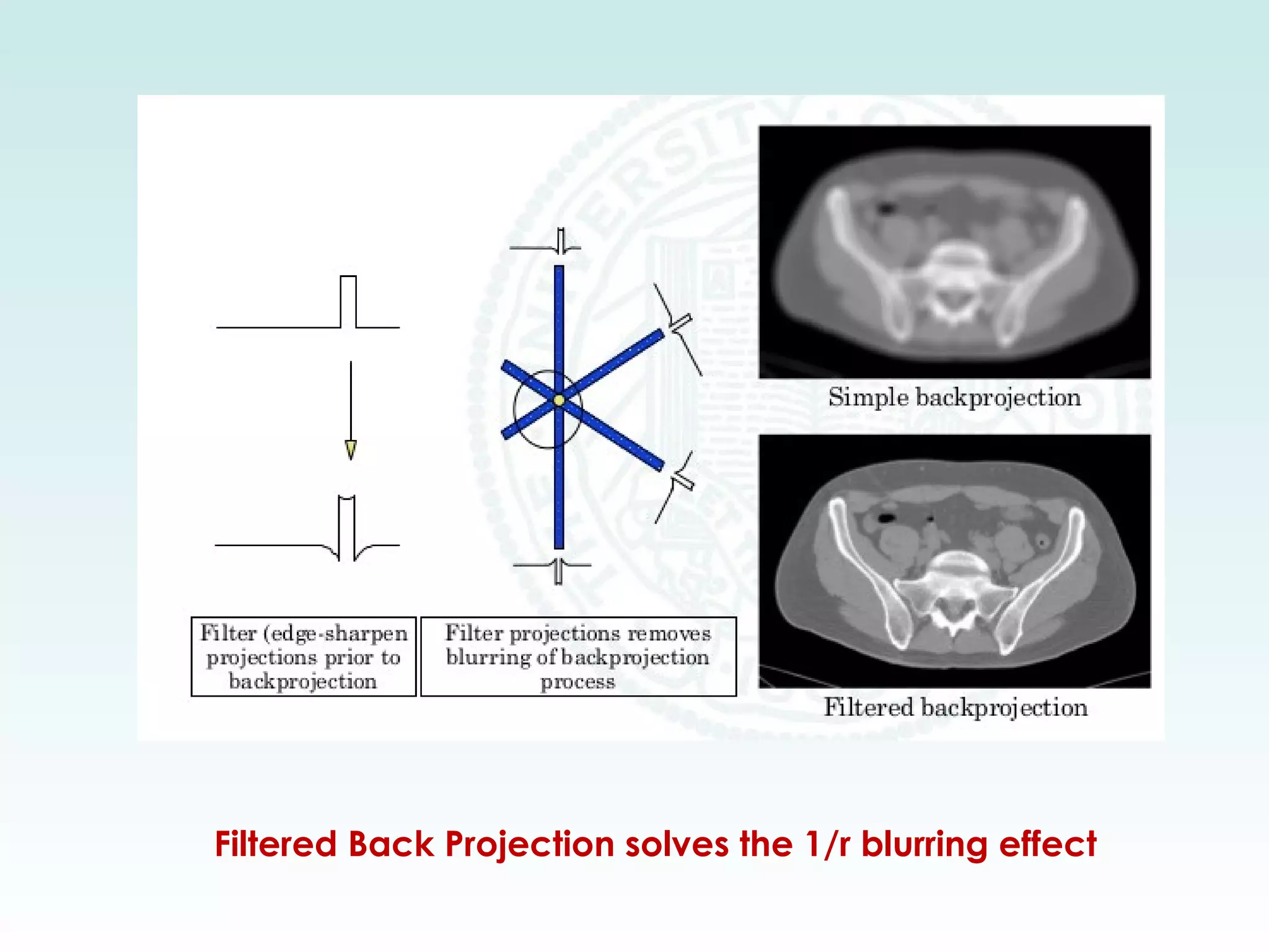 SPECT: Single Photon Emission Computed Tomography | PPT