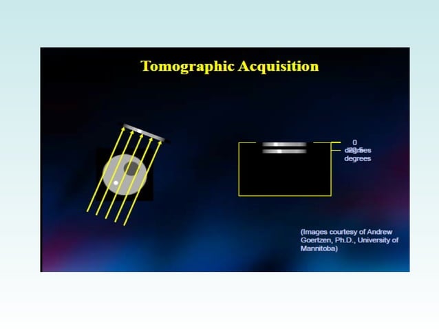 SPECT: Single Photon Emission Computed Tomography | PPT