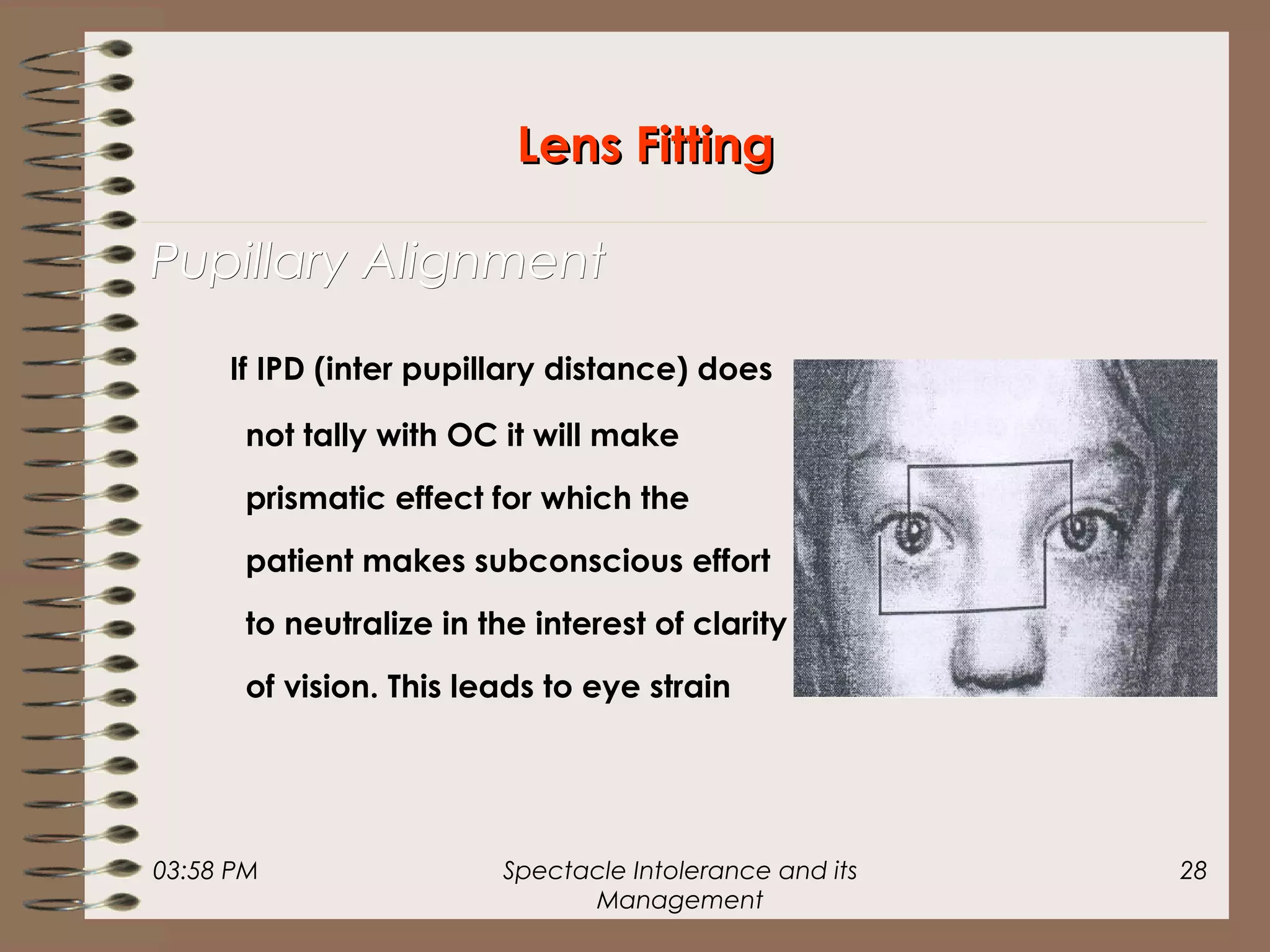 Spectacle intolerance | PPT