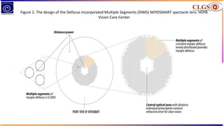 Spectacle Lens MiOYSMART RAMJI PANDEY CONSULTANT OPTOMETRIST | PPTX