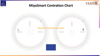 Spectacle Lens MiOYSMART RAMJI PANDEY CONSULTANT OPTOMETRIST | PPTX
