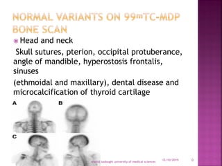 Spect artifact | PDF