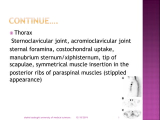 Spect artifact | PDF