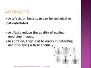 Spect artifact | PDF