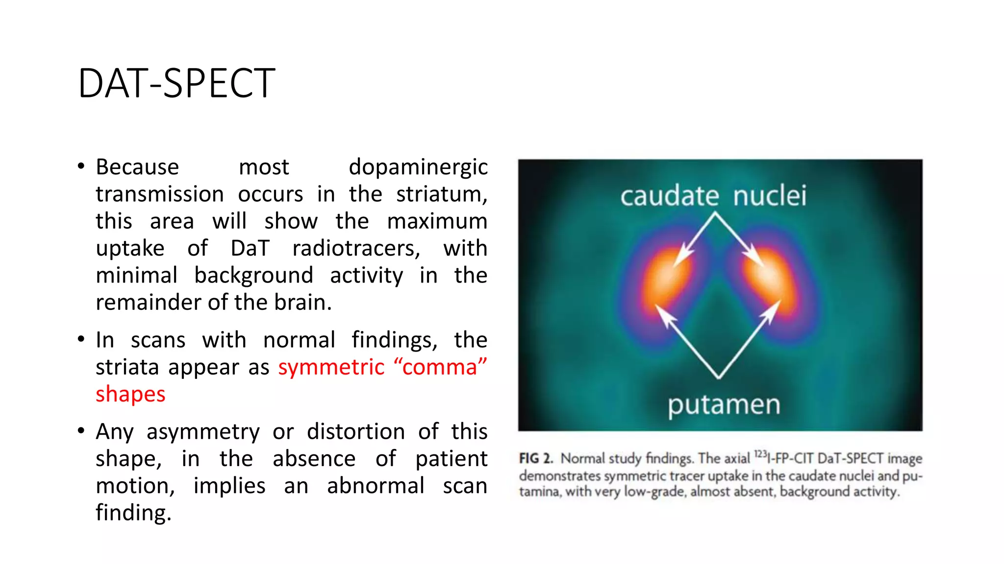 Spect in parkinsonism | PPTX