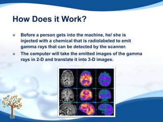 Spect medicine | PPTX