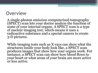 SPECT SCAN | PPTX