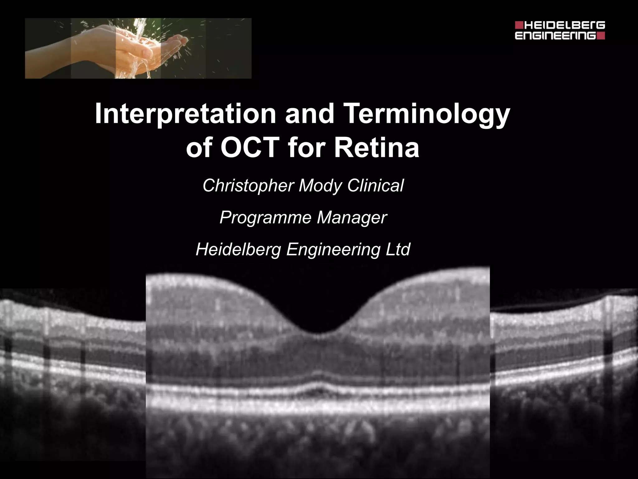 Spectralis oct normal anatomy & systematic interpretation. | PDF