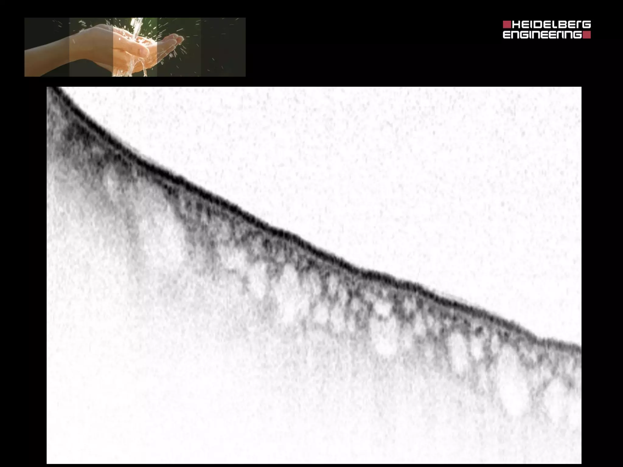Spectralis oct normal anatomy & systematic interpretation. | PDF