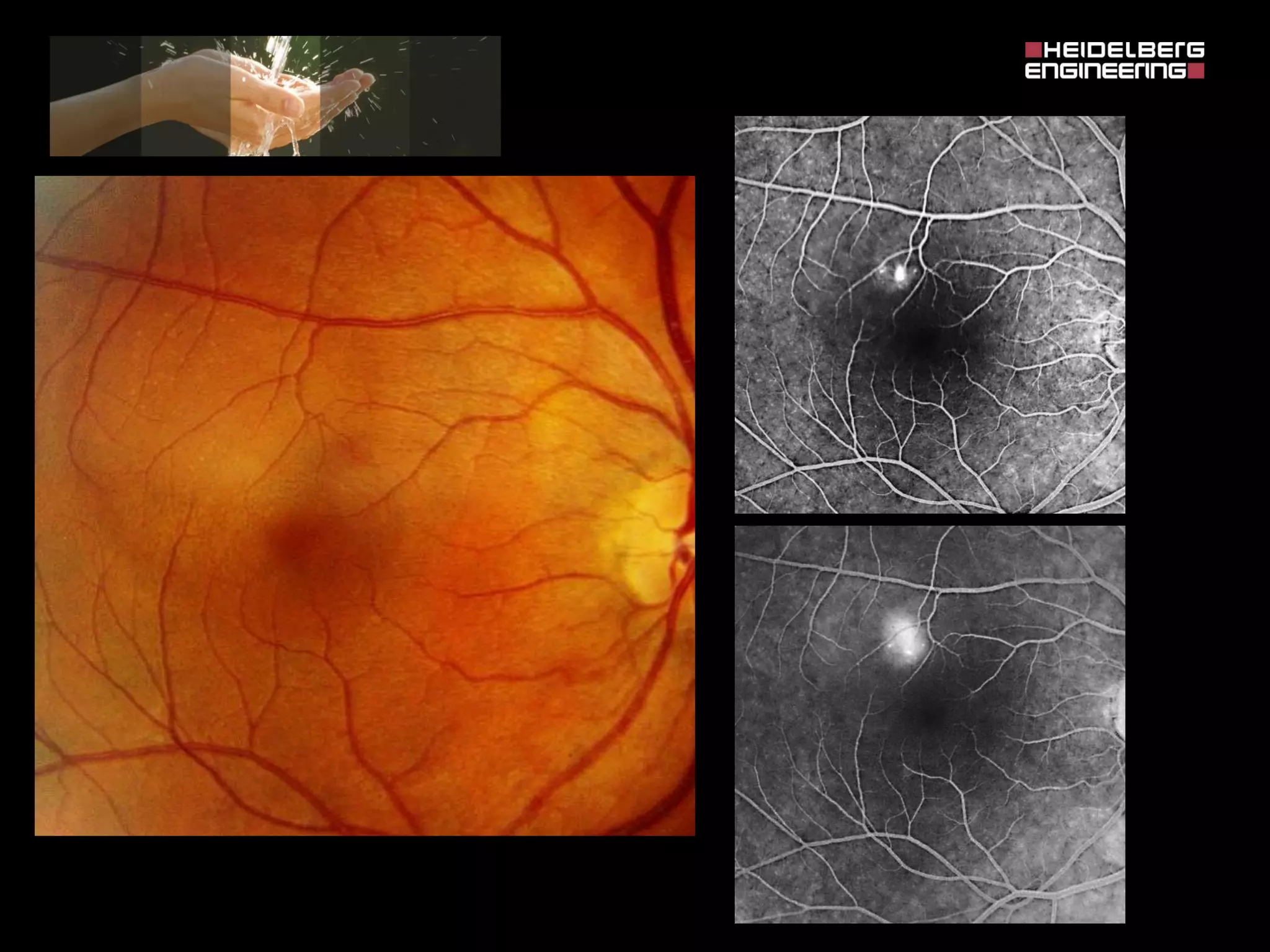 Spectralis oct normal anatomy & systematic interpretation. | PDF