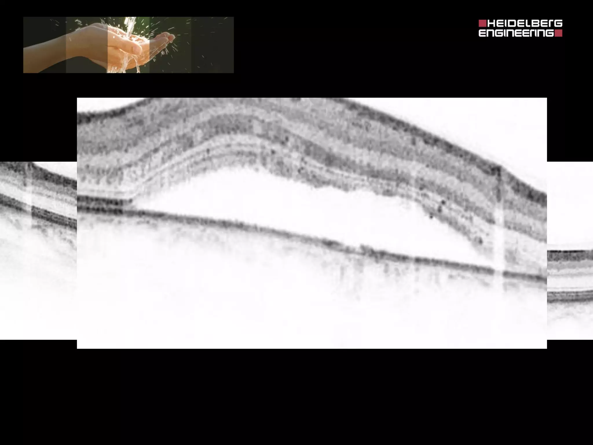 Spectralis oct normal anatomy & systematic interpretation. | PDF