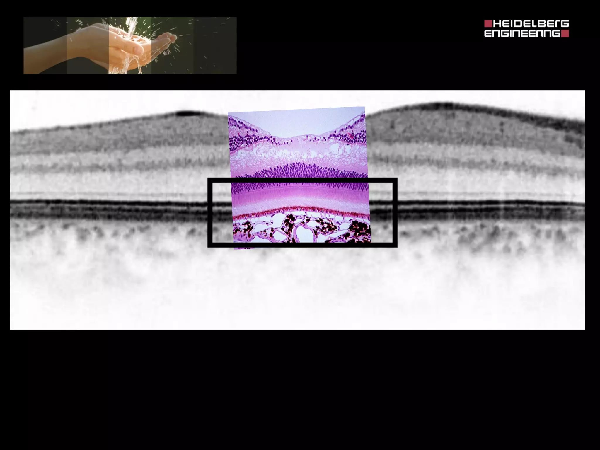 Spectralis oct normal anatomy & systematic interpretation. | PDF