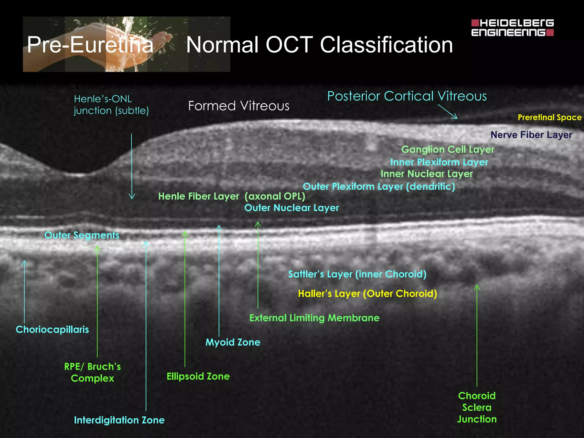 Spectralis oct normal anatomy & systematic interpretation. | PDF