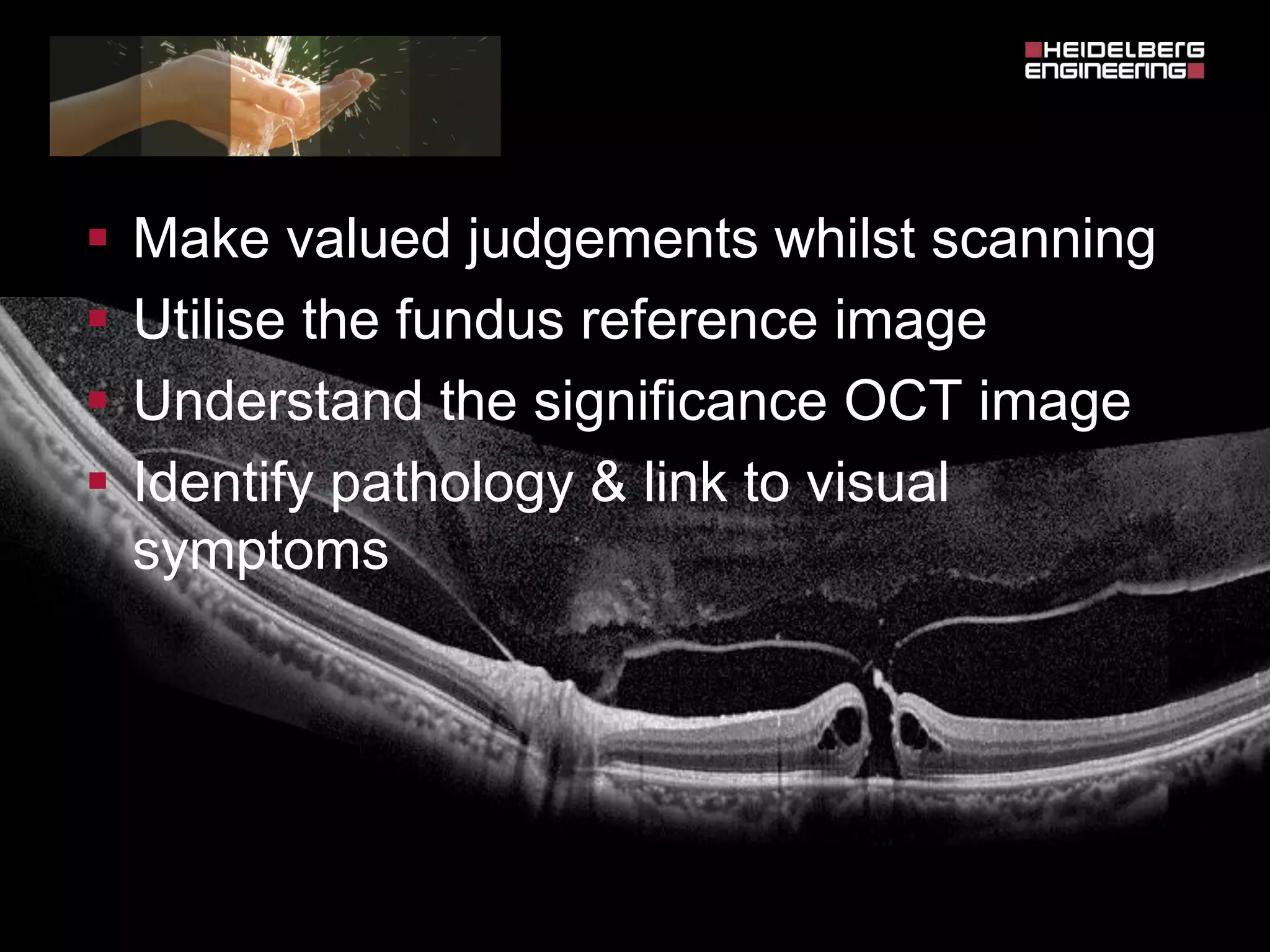 Spectralis oct normal anatomy & systematic interpretation. | PDF