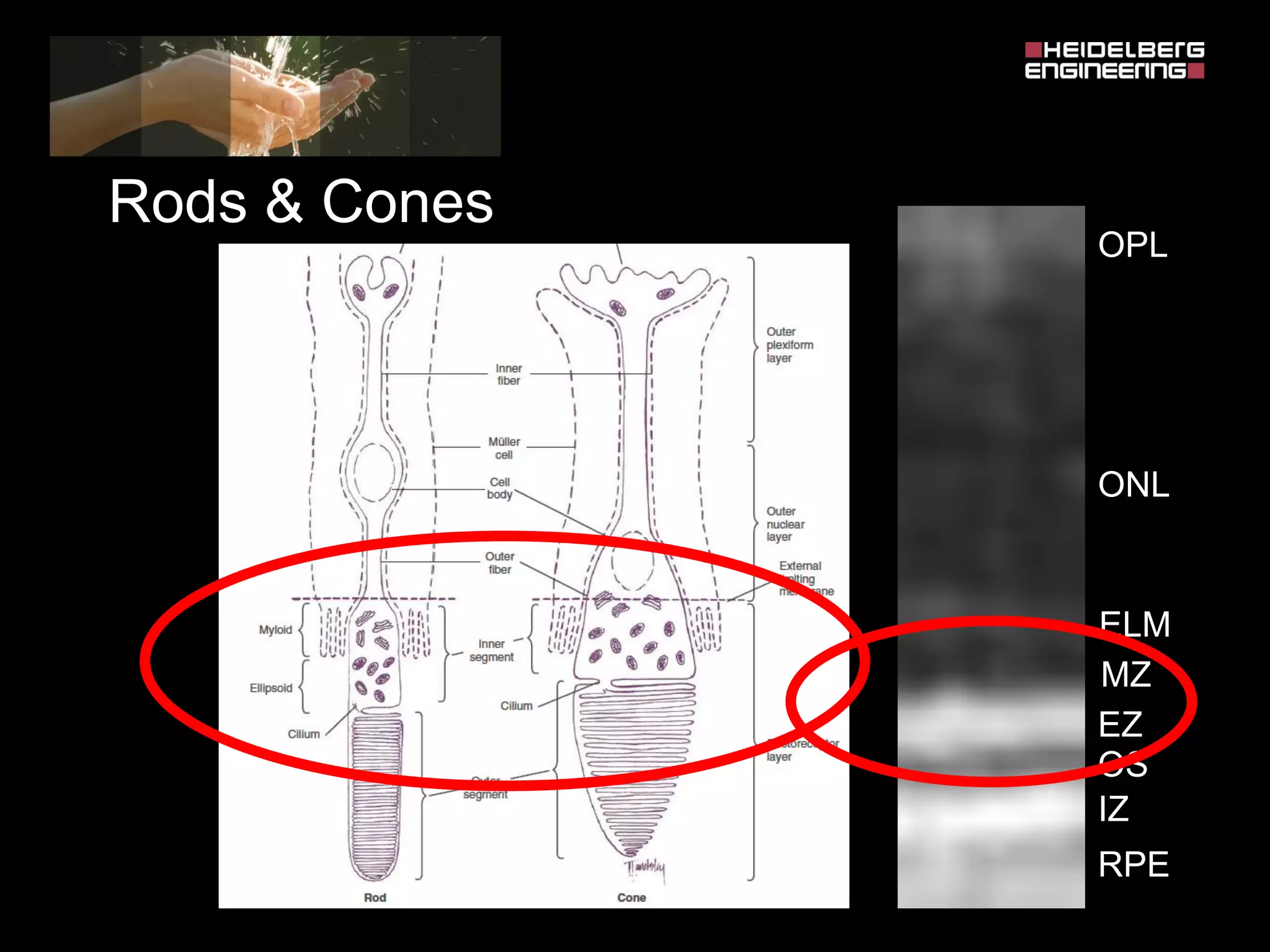 Spectralis oct normal anatomy & systematic interpretation. | PDF